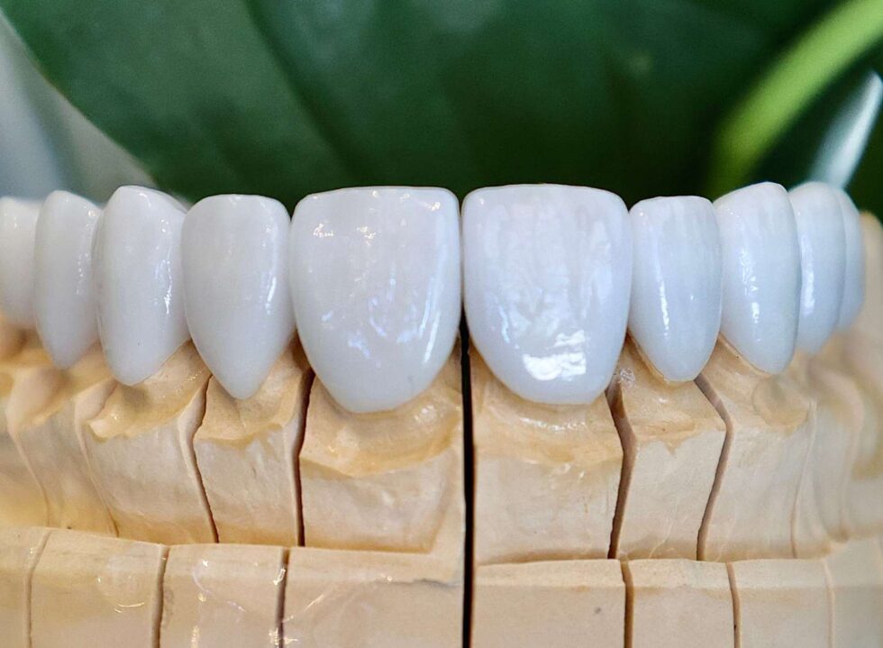 Bondi Junction Cosmetic Dentist | Sydney Cosmetic Dentist